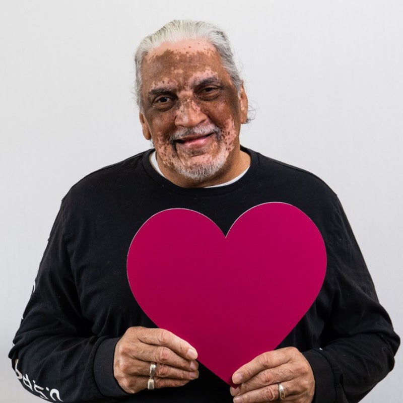 Harold Lewis - Heart failure